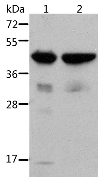 ACTA1 Antibody - SAB | Signalway Antibody