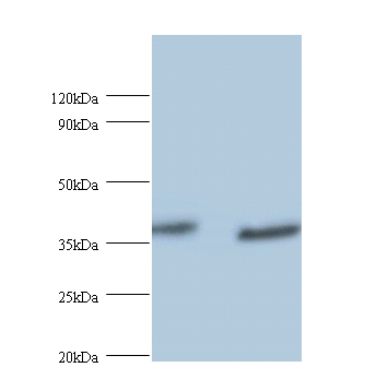 UV excision repair protein RAD23 homolog A Polyclonal Antibody - SAB ...