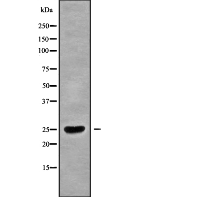 RAB32 Antibody - SAB | Signalway Antibody