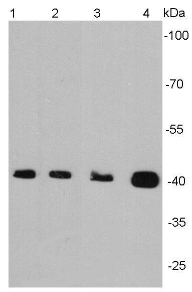 Alpha smooth muscle Actin Antibody - SAB | Signalway Antibody