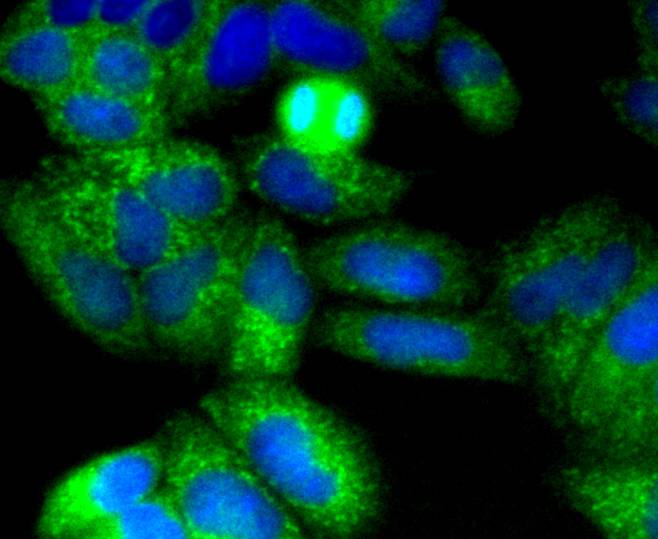 p75 NGF Receptor Rabbit mAb - SAB | Signalway Antibody