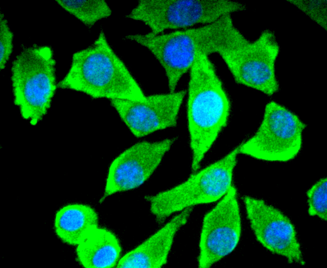 Tau Rabbit mAb - SAB | Signalway Antibody