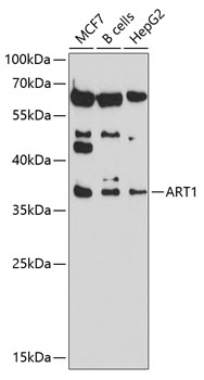 ART1 Polyclonal Antibody - SAB | Signalway Antibody