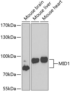 MID1 Polyclonal Antibody - SAB | Signalway Antibody