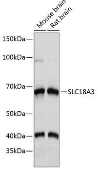 SLC18A3 Rabbit Polyclonal Antibody - SAB | Signalway Antibody