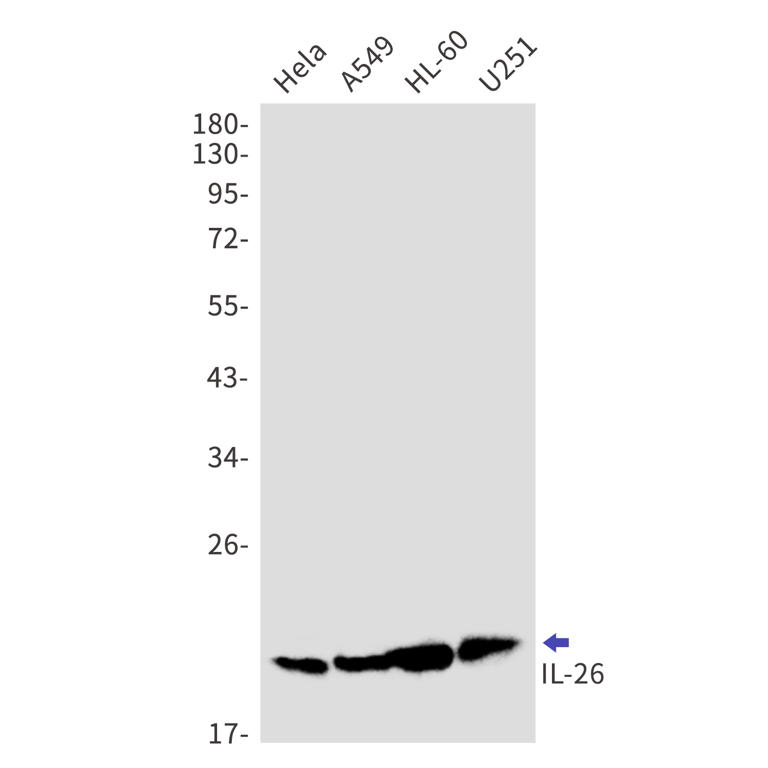 IL 26 Rabbit mAb - SAB | Signalway Antibody