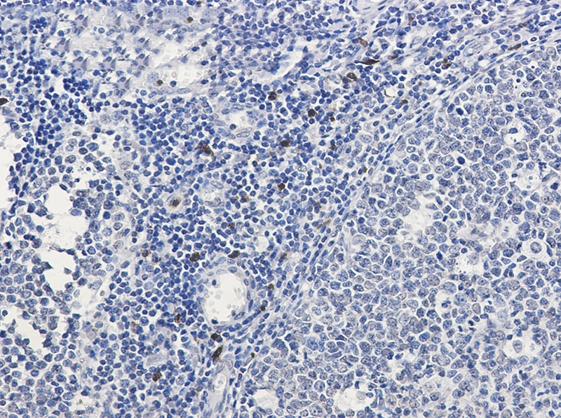 IL 26 Rabbit mAb - SAB | Signalway Antibody