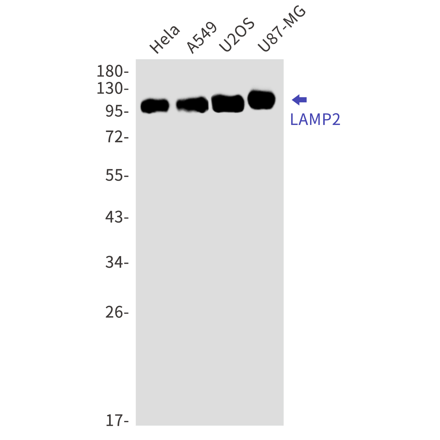 LAMP2 Rabbit mAb - SAB | Signalway Antibody
