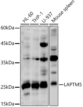 LAPTM5 Polyclonal Antibody - SAB | Signalway Antibody