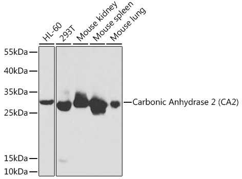 CA2 Antibody - SAB | Signalway Antibody