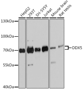 DDX5 Antibody - SAB | Signalway Antibody