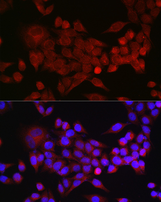 INHBA Antibody - SAB | Signalway Antibody