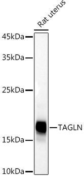 TAGLN antibody - SAB | Signalway Antibody