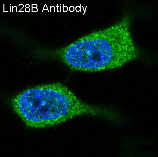 Lin28B Rabbit mAb - SAB | Signalway Antibody