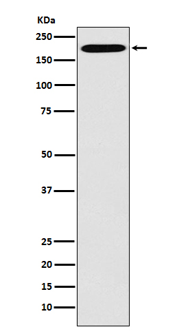 Clathrin heavy chain Rabbit mAb - SAB | Signalway Antibody