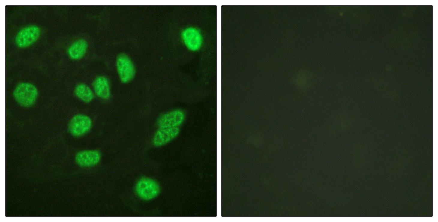 B-Myb Polyclonal Antibody - SAB | Signalway Antibody