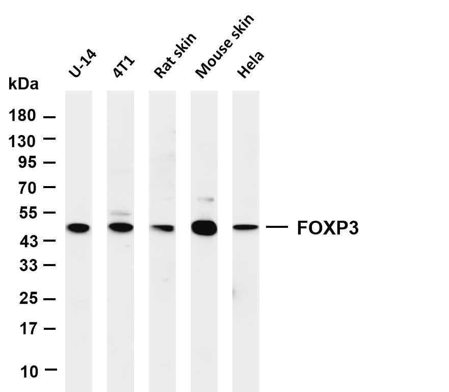 FOXP3 Rabbit mAb - SAB | Signalway Antibody